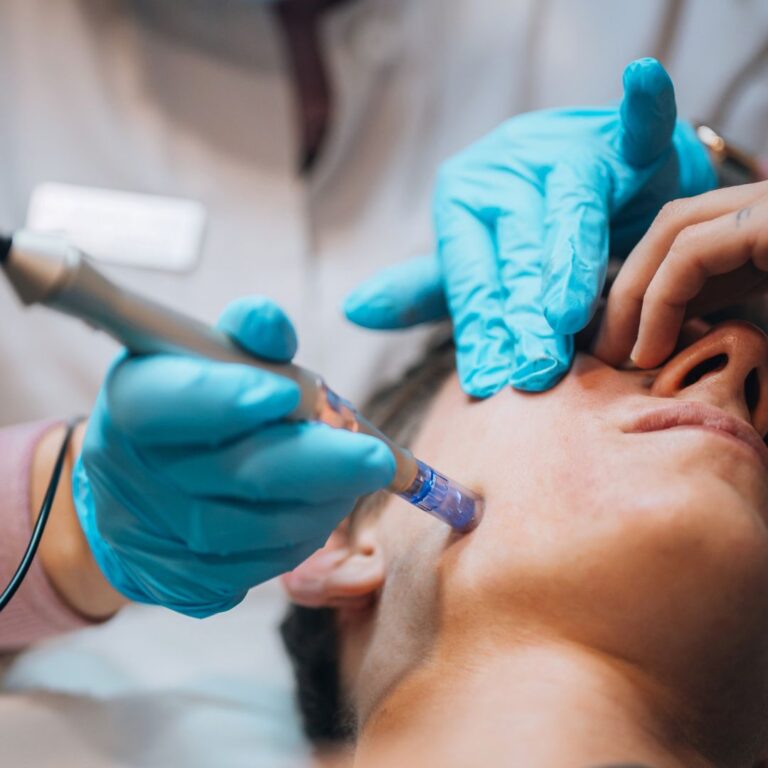 Dermapen Face – perfectporeacademy.online